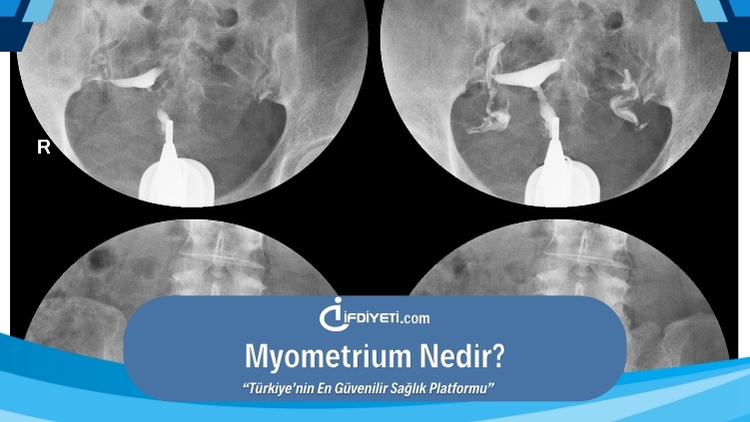 Myometrium Nedir? | İFDİYETİ.COM