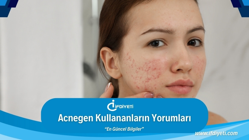 Acnegen Kullananlar Yorumları | İFDİYETİ.COM